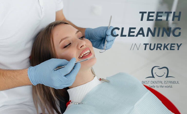 Teeth Cleaning in Turkey - Best Dental Istanbul